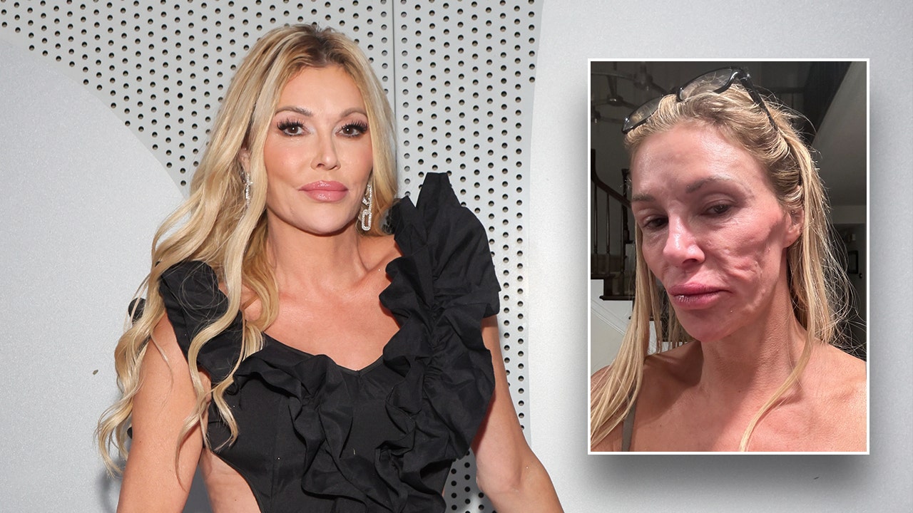 Brandi Glanville exposed her $100,000+ battle with a parasitic ...