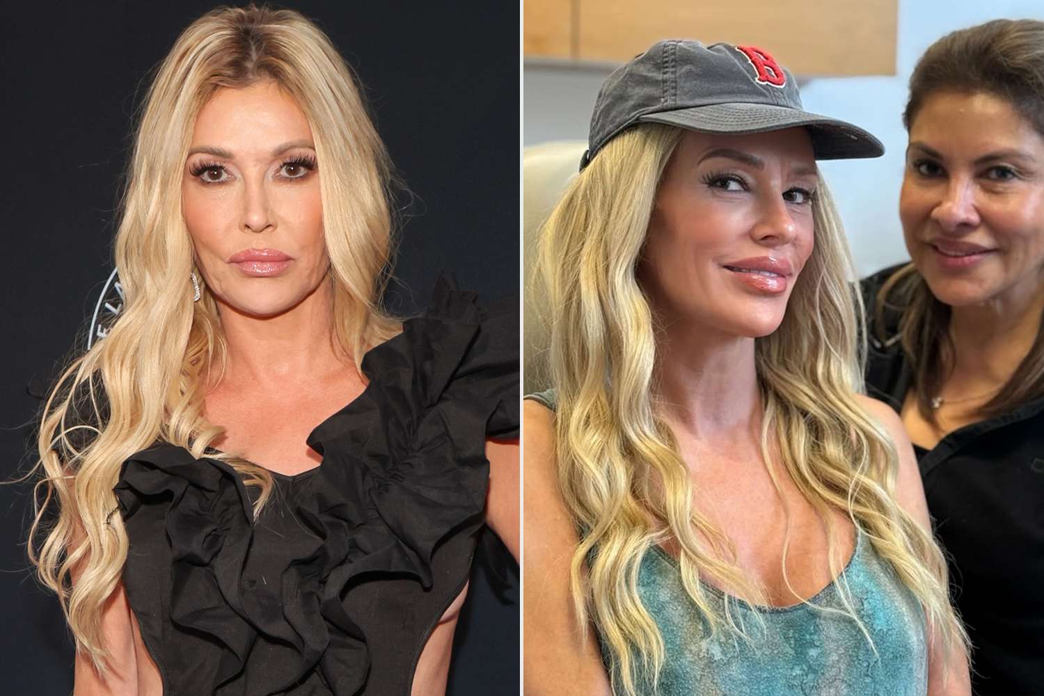 Brandi Glanville exposed her $100,000+ battle with a parasitic ...