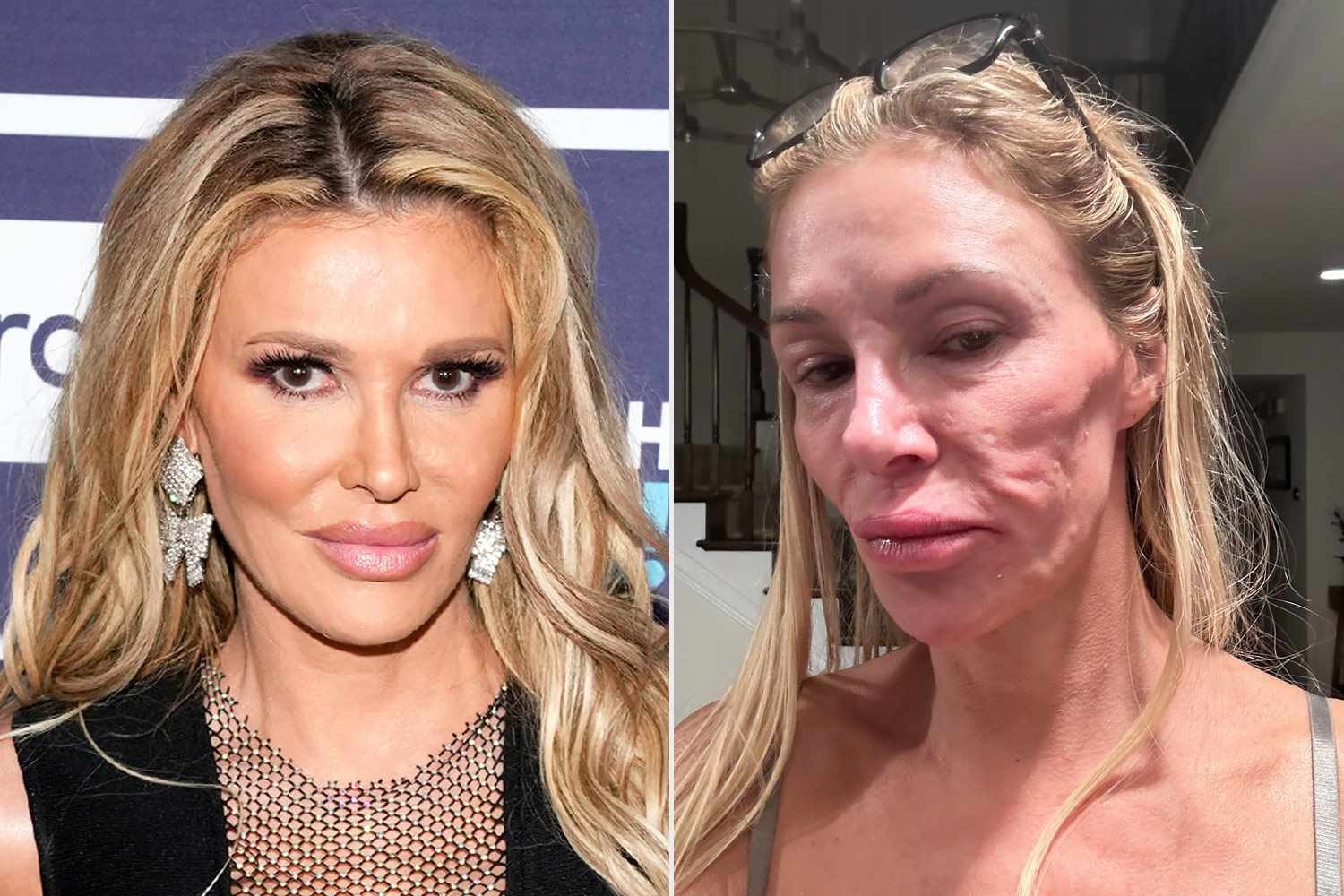 Brandi Glanville exposed her $100,000+ battle with a parasitic ...