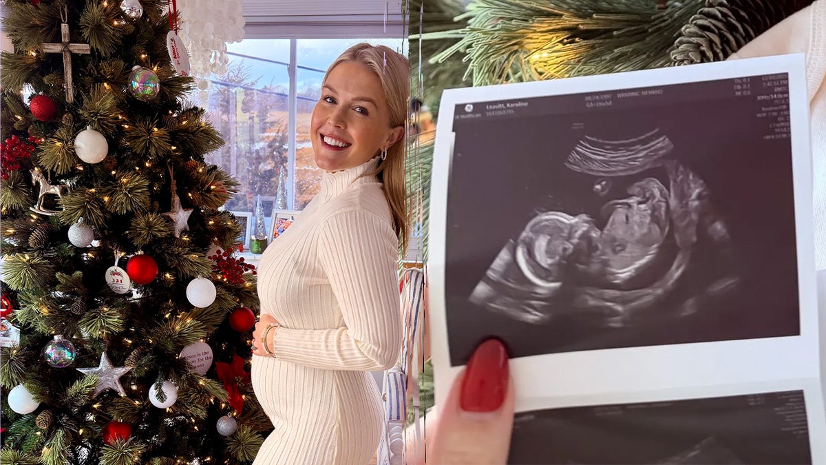 Karoline Leavitt’s husband has shared the latest photos of her ...